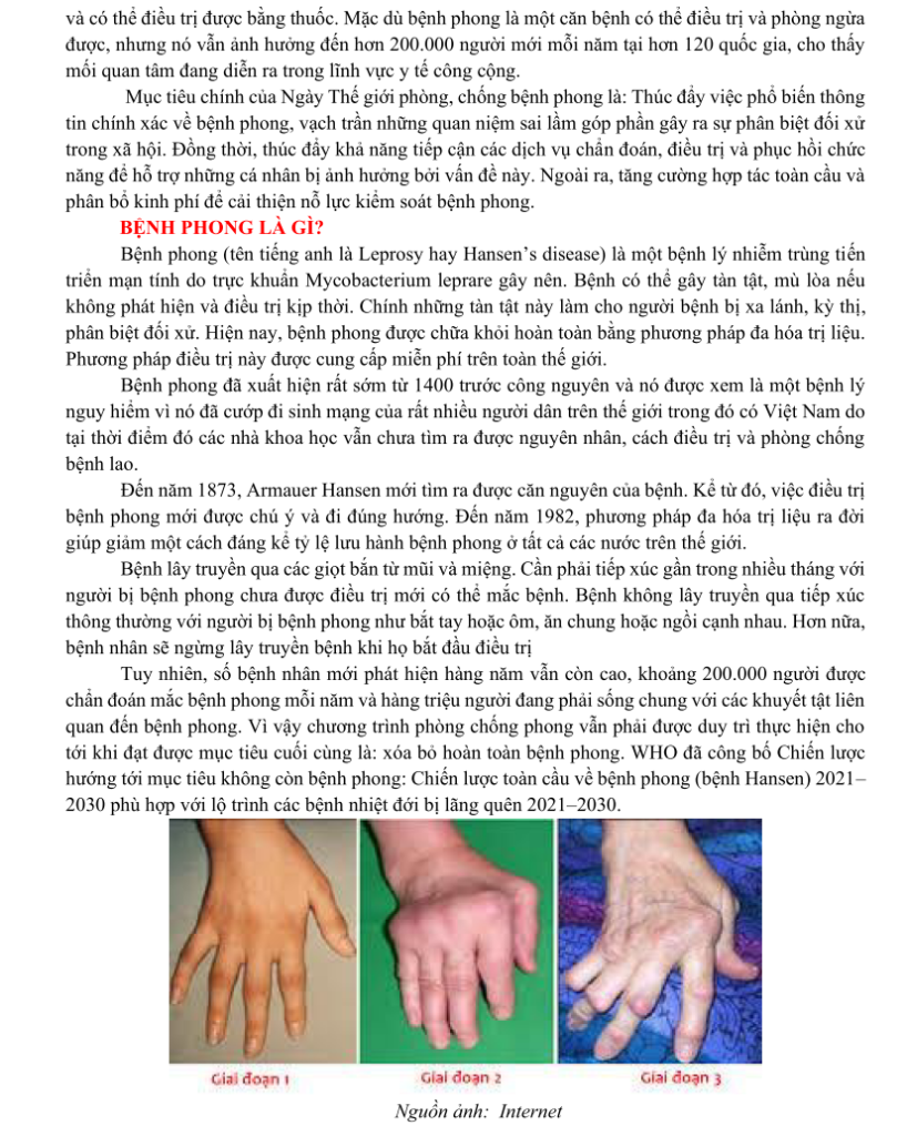 BỆNH PHONG VÀ NHỮNG VẤN ĐỀ CẦN QUAN TÂM - Bệnh Viện Đa Khoa Khu Vực Củ Chi